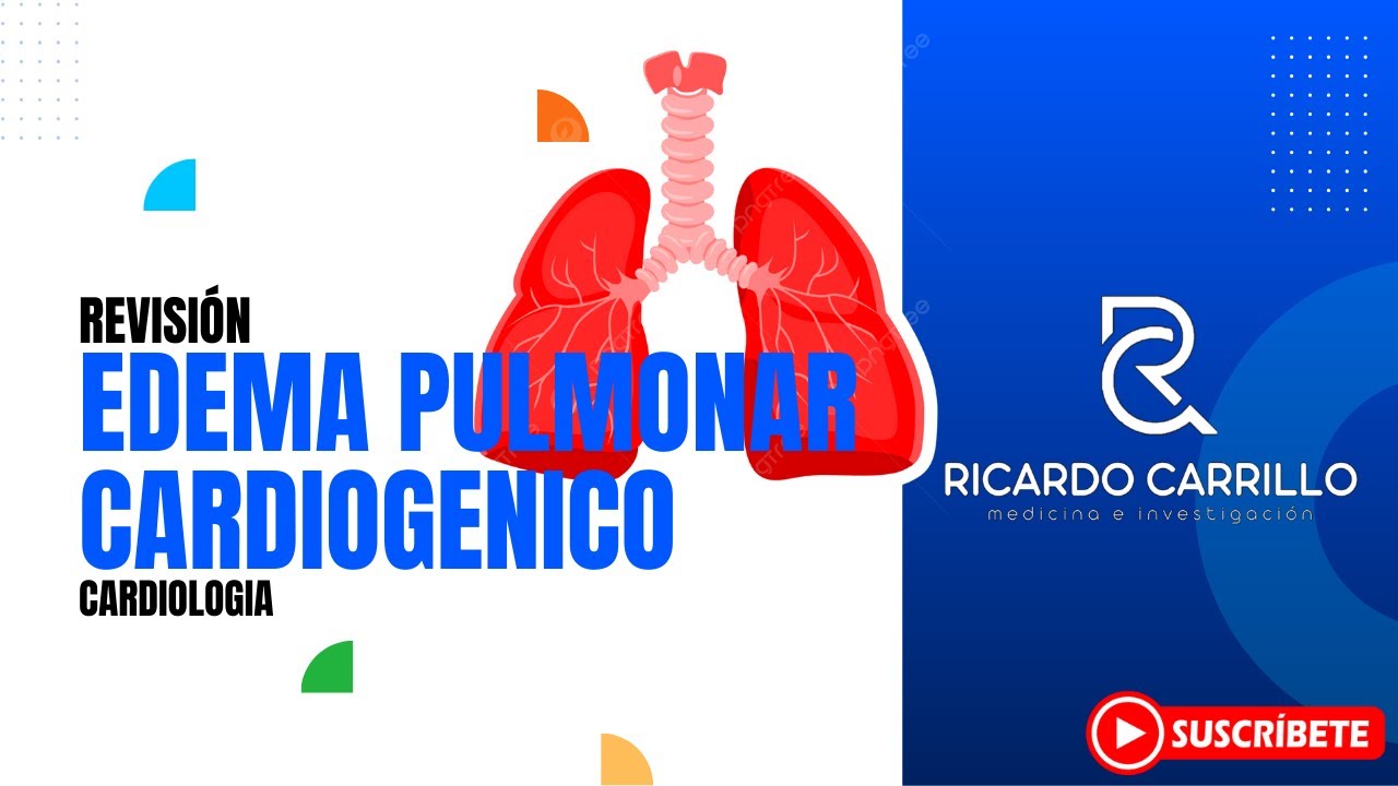 Edema agudo de pulmón cardiogénico l Cardiología - YouTube