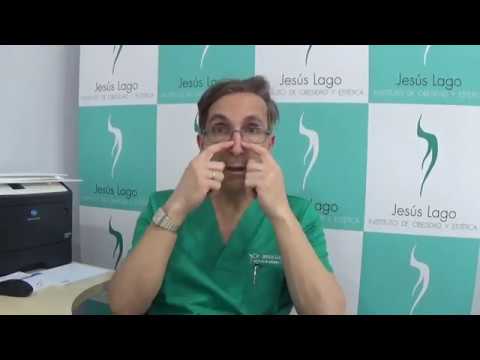 Dr Jesus Lago - Rinoplastia - YouTube