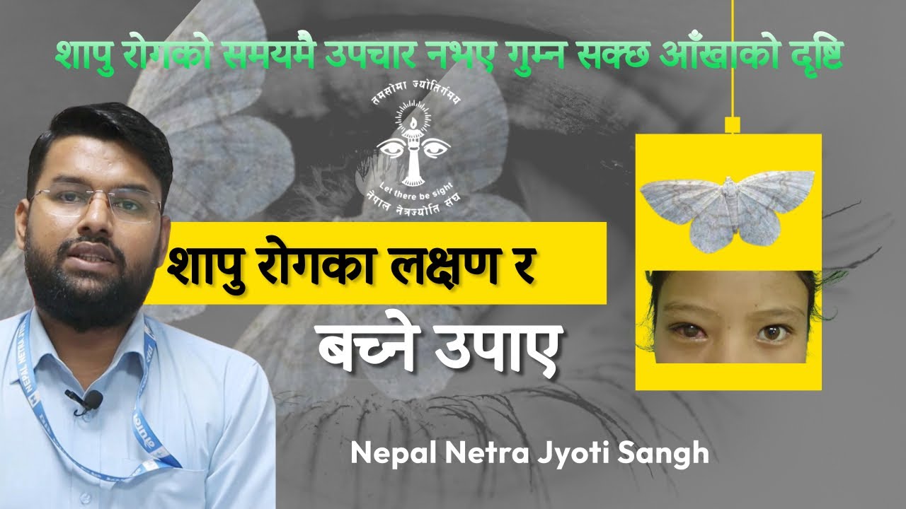 आँखाको दृष्टि नै गुम्नसक्ने शापु रोगका लक्षण र बच्ने उपाए- NNJS - YouTube