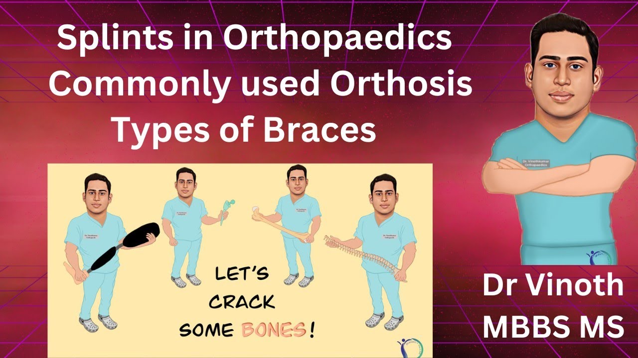 Commonly used Orthosis| Orthotics| Types of Splints in Ortho ...