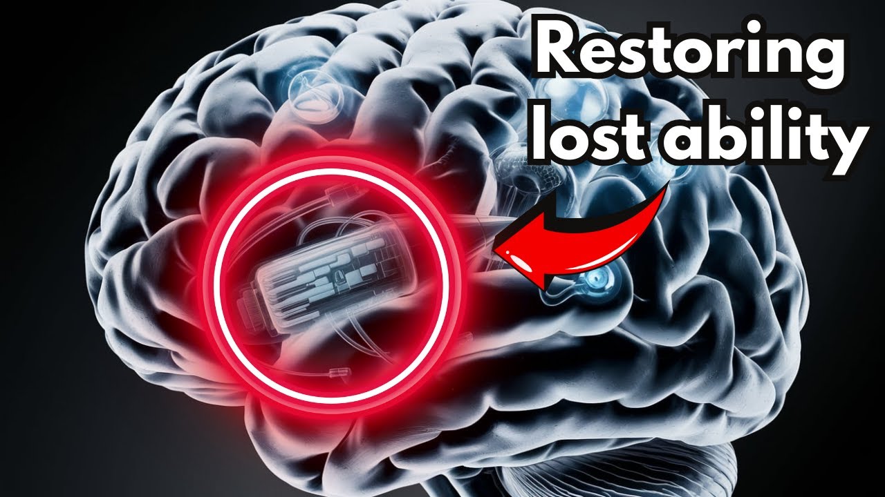 How Brain Implants Work! Explained in 5 Mins - YouTube