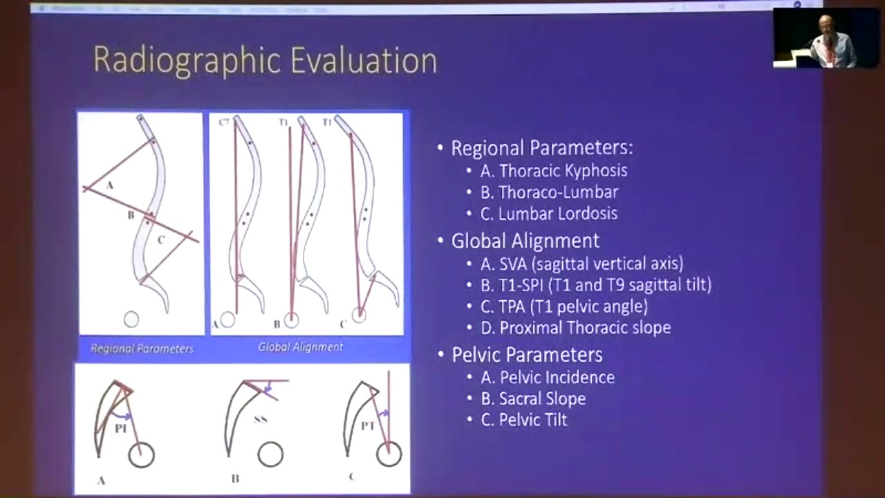 2 Sagittal Balance in Deformity - YouTube