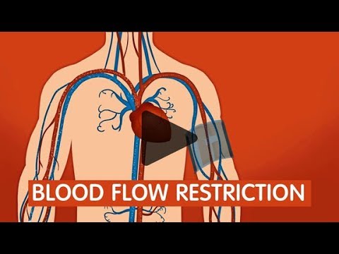 Blood Flow Restriction Information Video - YouTube