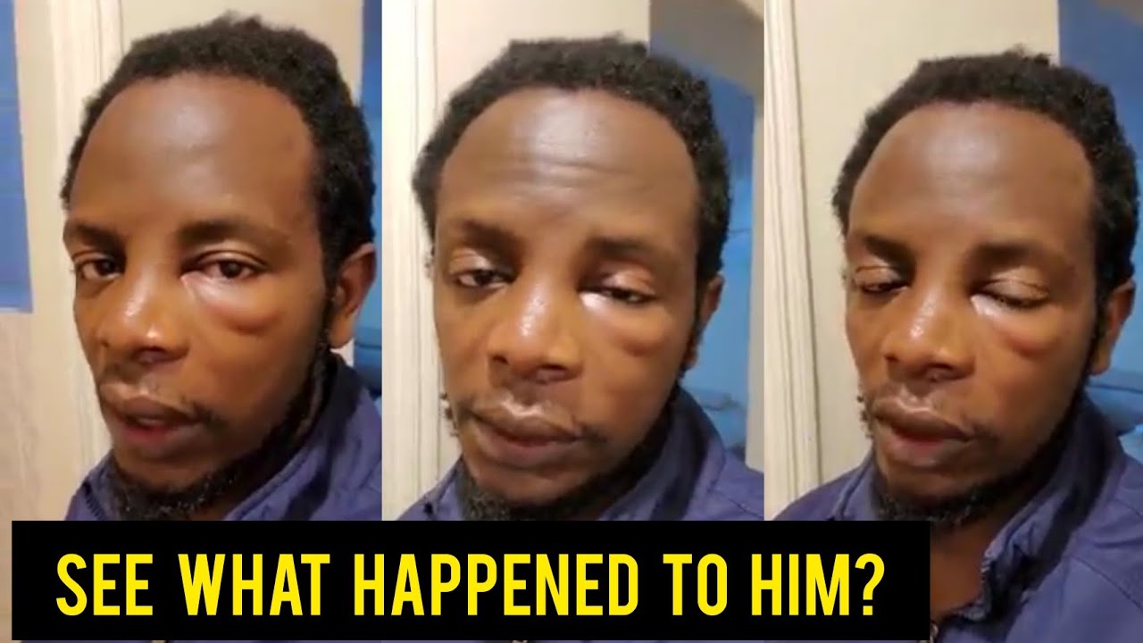 CHURCHILL SHOW COMEDIAN PROF HAMO EXPLAINING WHAT HAPPENED TO HIM ...