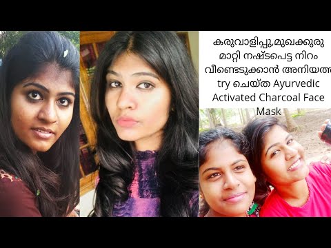 കരുവാളിപ്പ് മാറ്റി നിറം വീണ്ടെടുക്കാൻ,മുഖക്കുരു മാറാൻ Activated charcoal mask|Carbon Bae