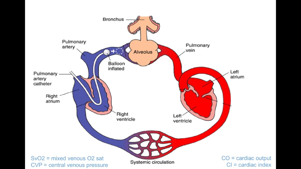 Shock - hemodynamics - YouTube