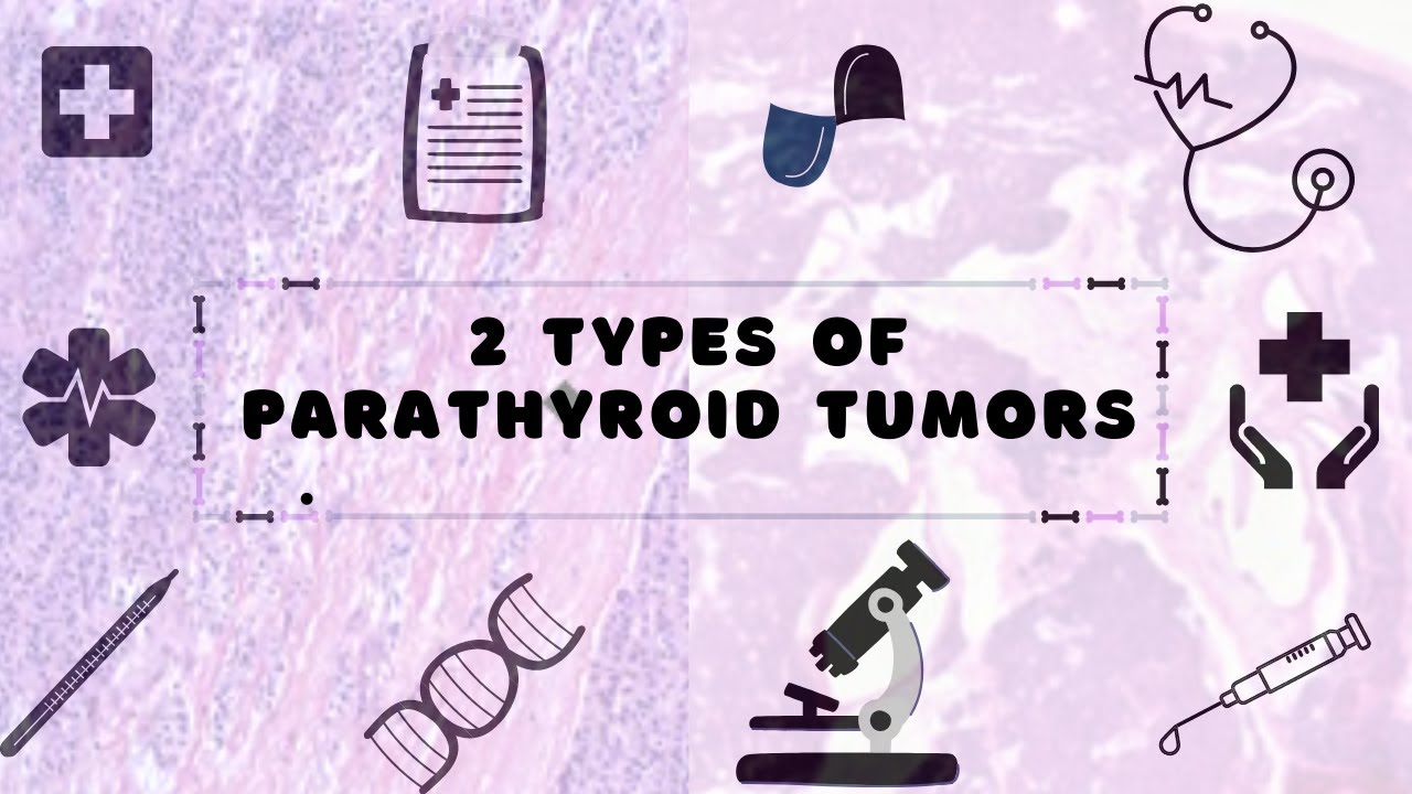 2 Types Of Parathyroid Tumors - YouTube