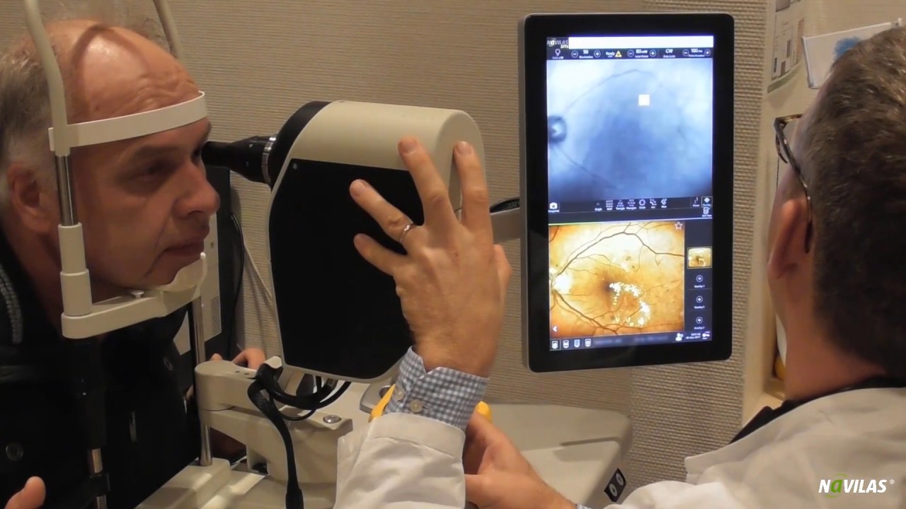 Einführung in die navigierte Lasertherapie der Netzhaut mit Navilas ...
