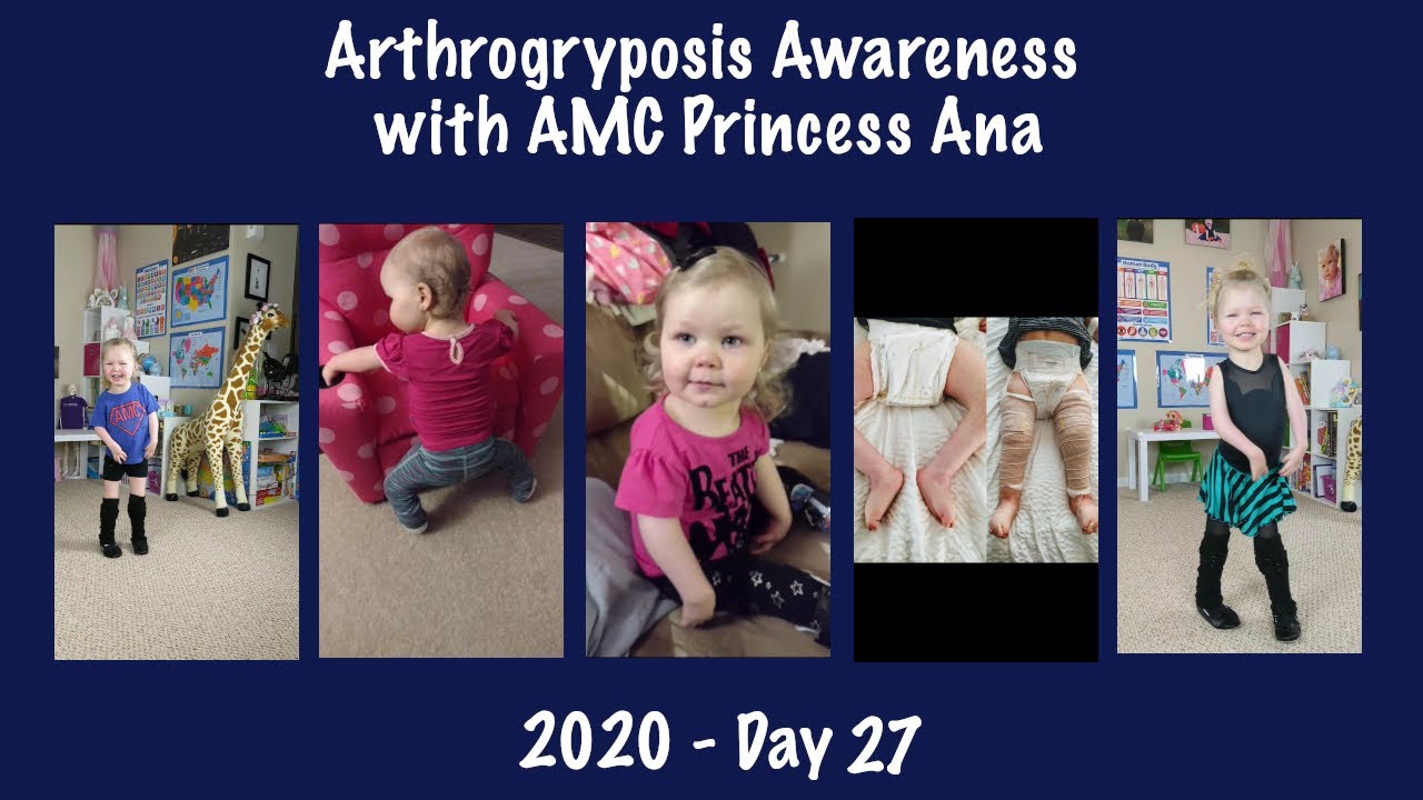 2020 Arthrogryposis Awareness with AMC Princess Ana - Day 27 - YouTube