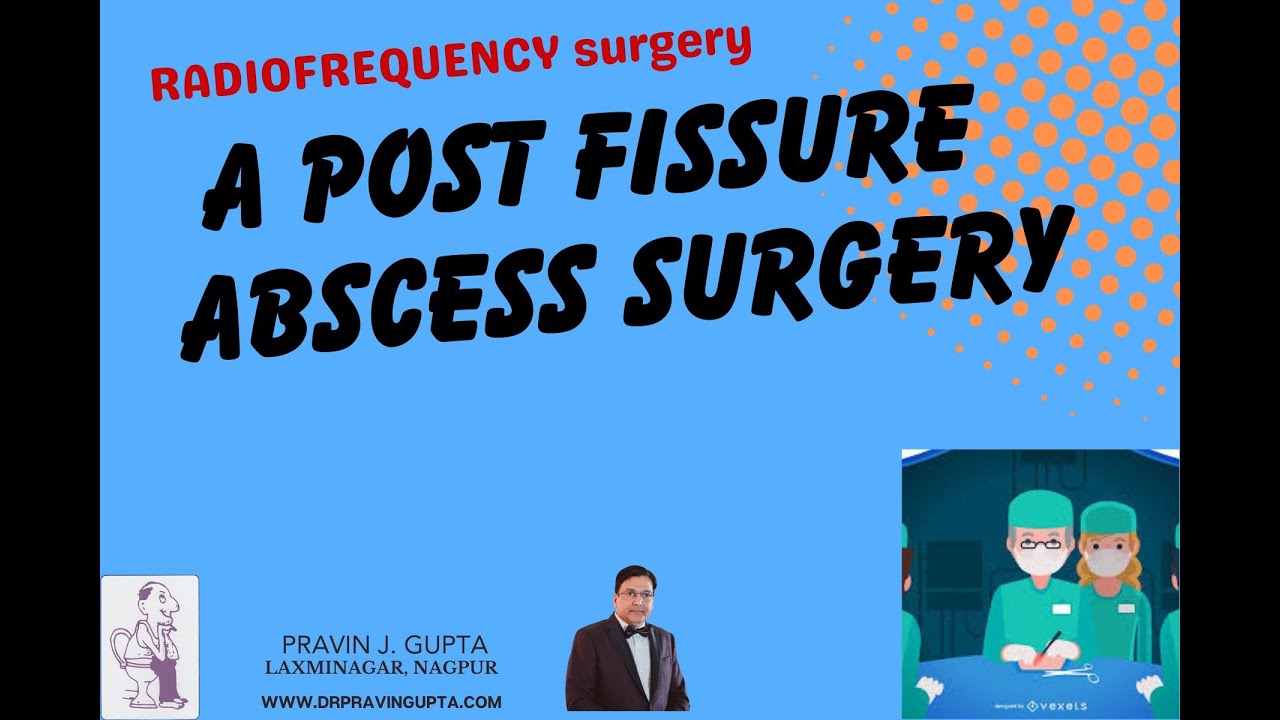 BURST ABSCESS IN A NEGLECTED ANAL FISSURE WITH SENTINEL PILE - YouTube