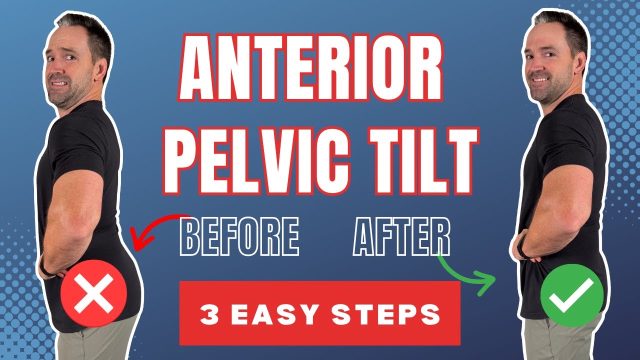 Fix Your Anterior Pelvic Tilt in 3 Simple Steps (Stop Arching Your Back ...