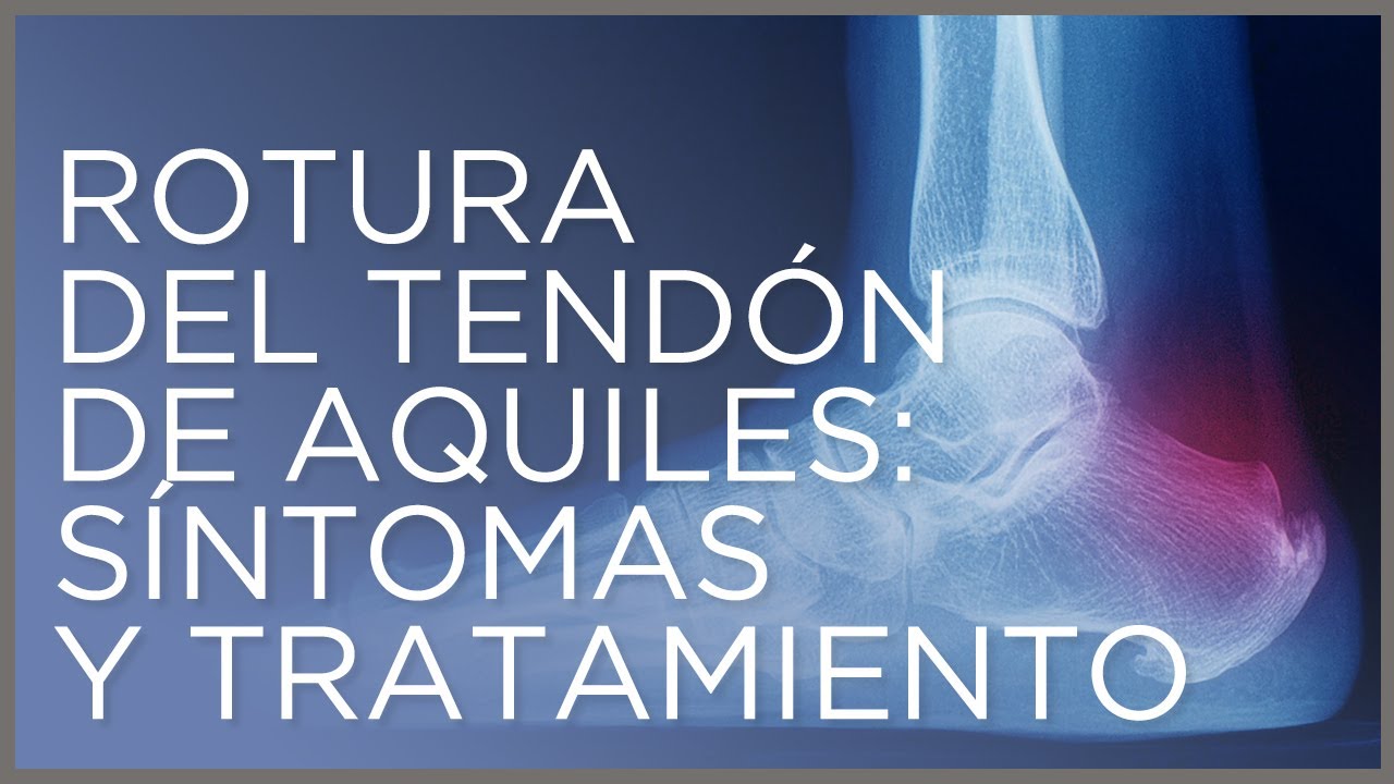 Rotura del tendón de Aquiles: síntomas y tratamiento - YouTube