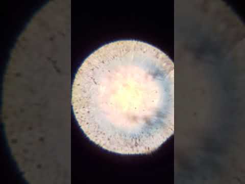 OBSERVATIONS DE LEVURE AU MICROSCOPE - YouTube