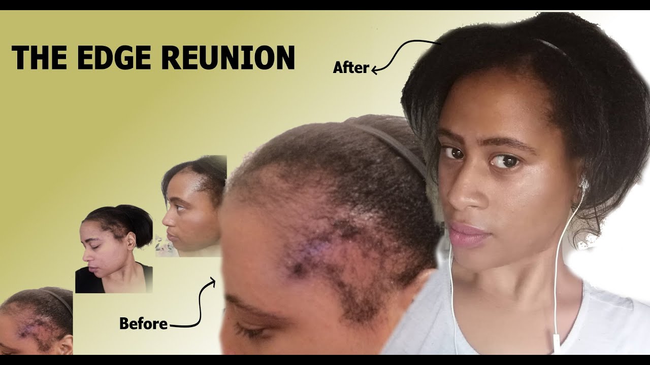 DIY edges growth - how to grow edges back fast - YouTube
