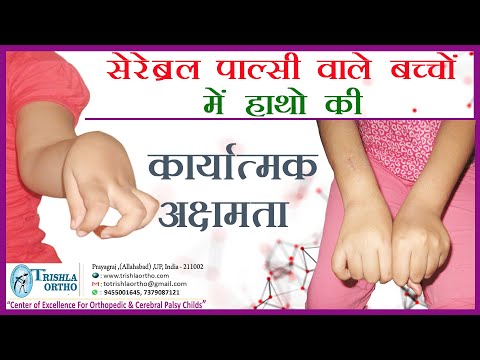Cerebral Palsy : Hand functional disability - YouTube