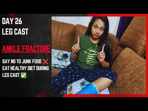 Ankle Fracture|Day 26|Leg Cast|Take VitaminD rich diet|Don't eat junk ...