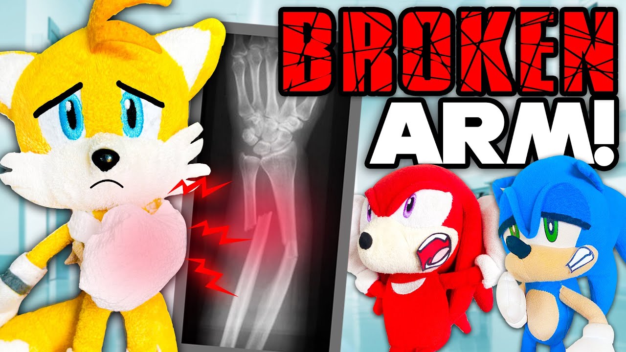 Tails' Broken Arm! - Sonic and Friends - YouTube
