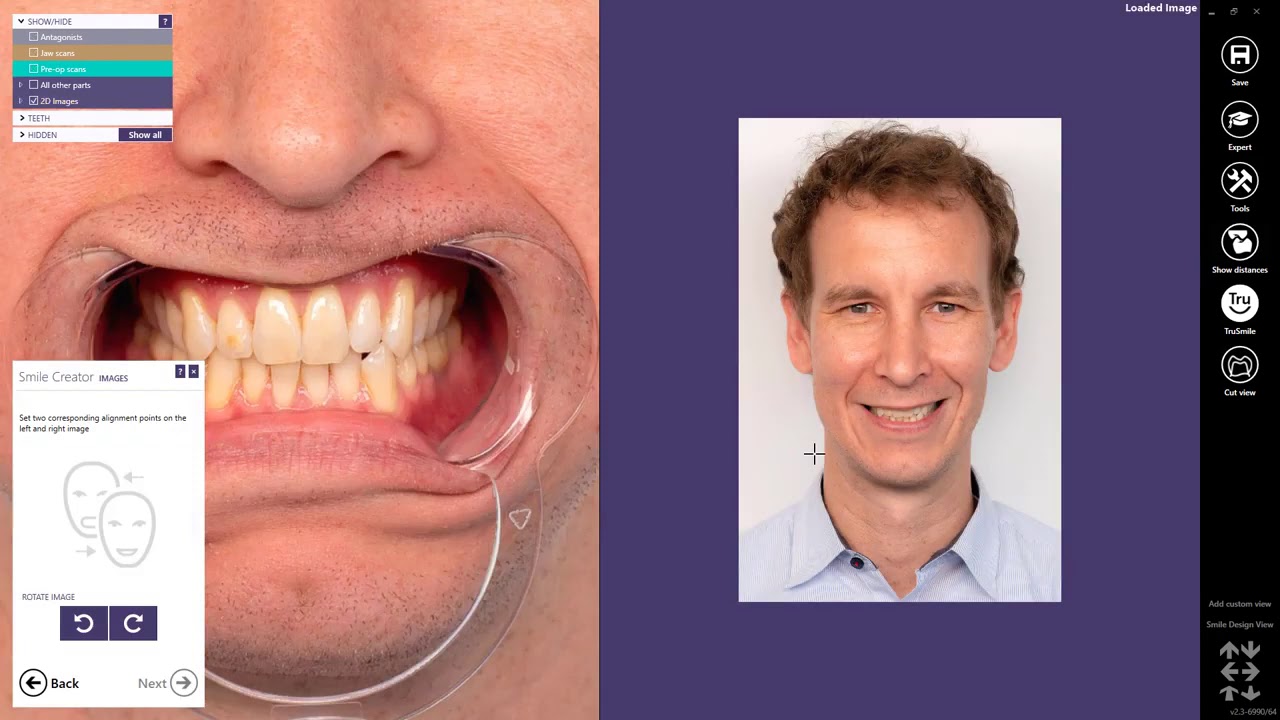 exocad Quick Guide Get the most out of your Smile Creator Module! - YouTube