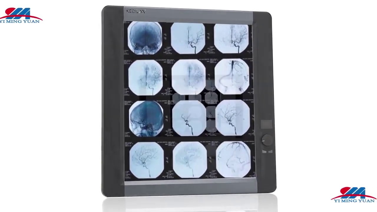 High Quality Medical Negatoscope X-ray Film Viewer - YouTube