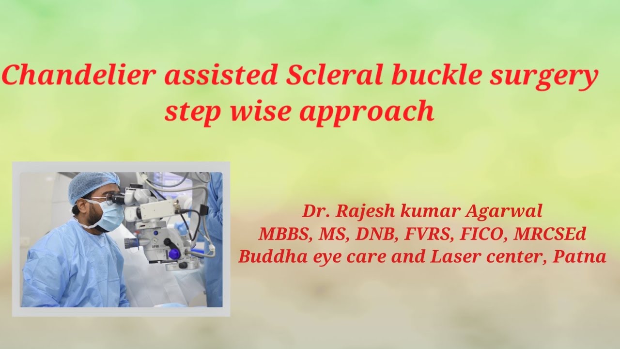 Chandelier assisted Scleral buckle surgery (retinal detachment) Retina ...