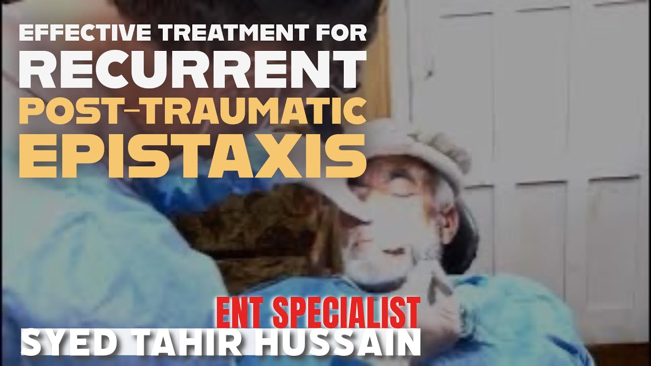 Effective Treatment for Recurrent Post-Traumatic Epistaxis - YouTube