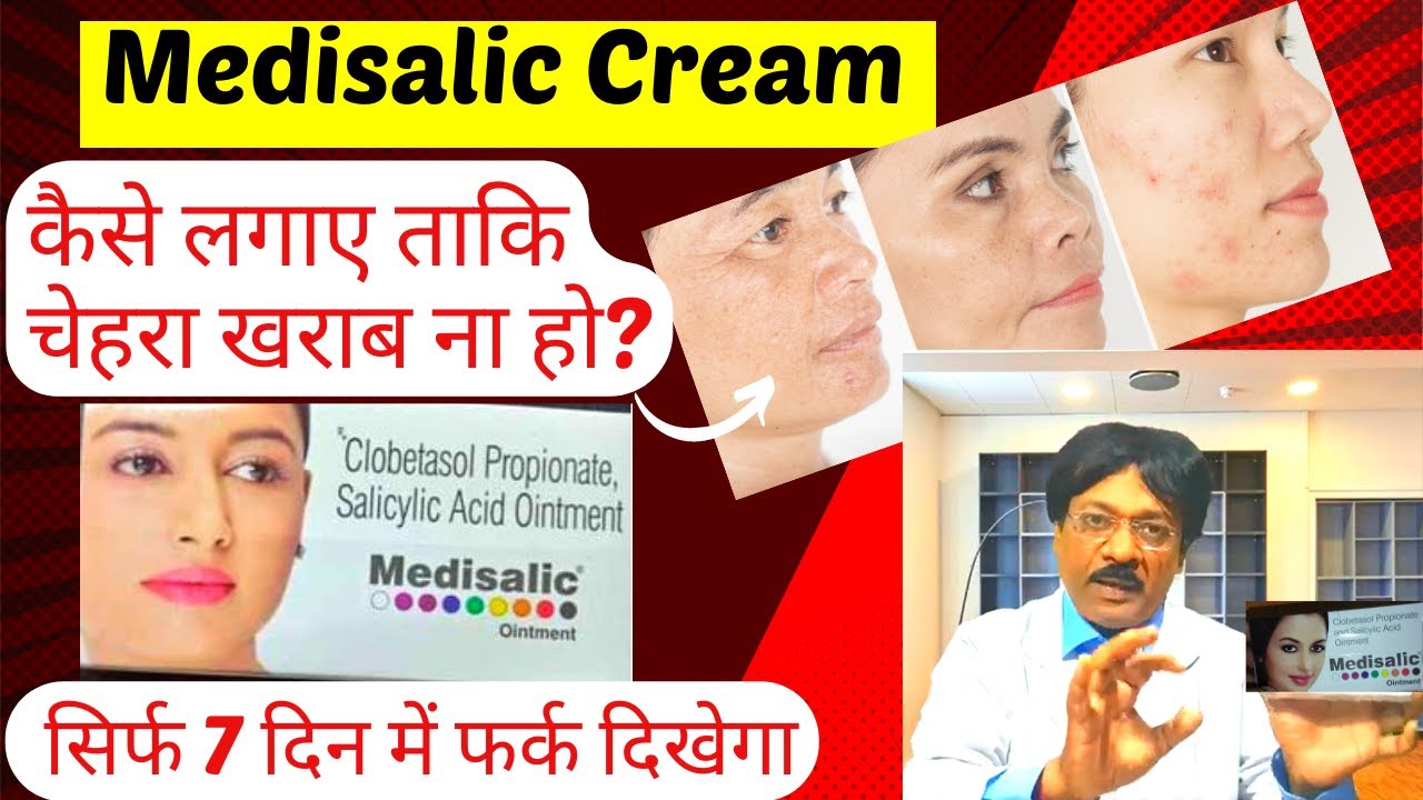 Medisalic cream :Medisalic cream ke fayde | Medisalic Cream For ...