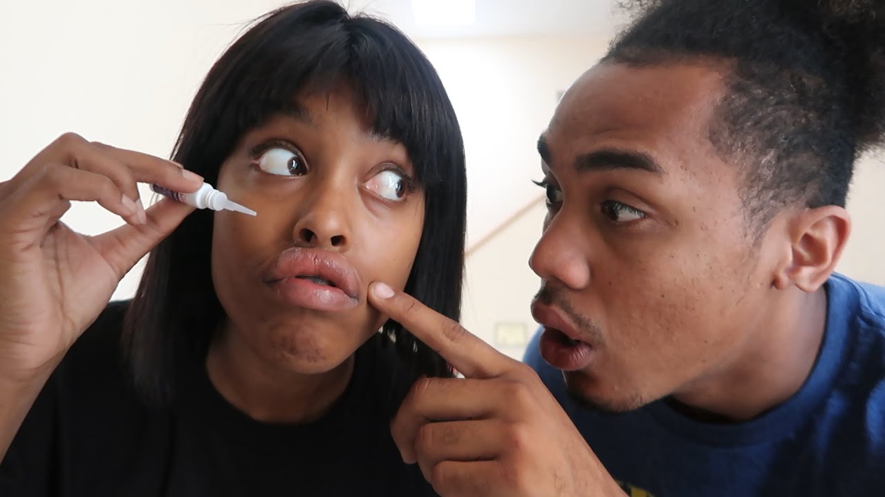 LIP FILLER PRANK ON BOYFRIEND!!! - YouTube