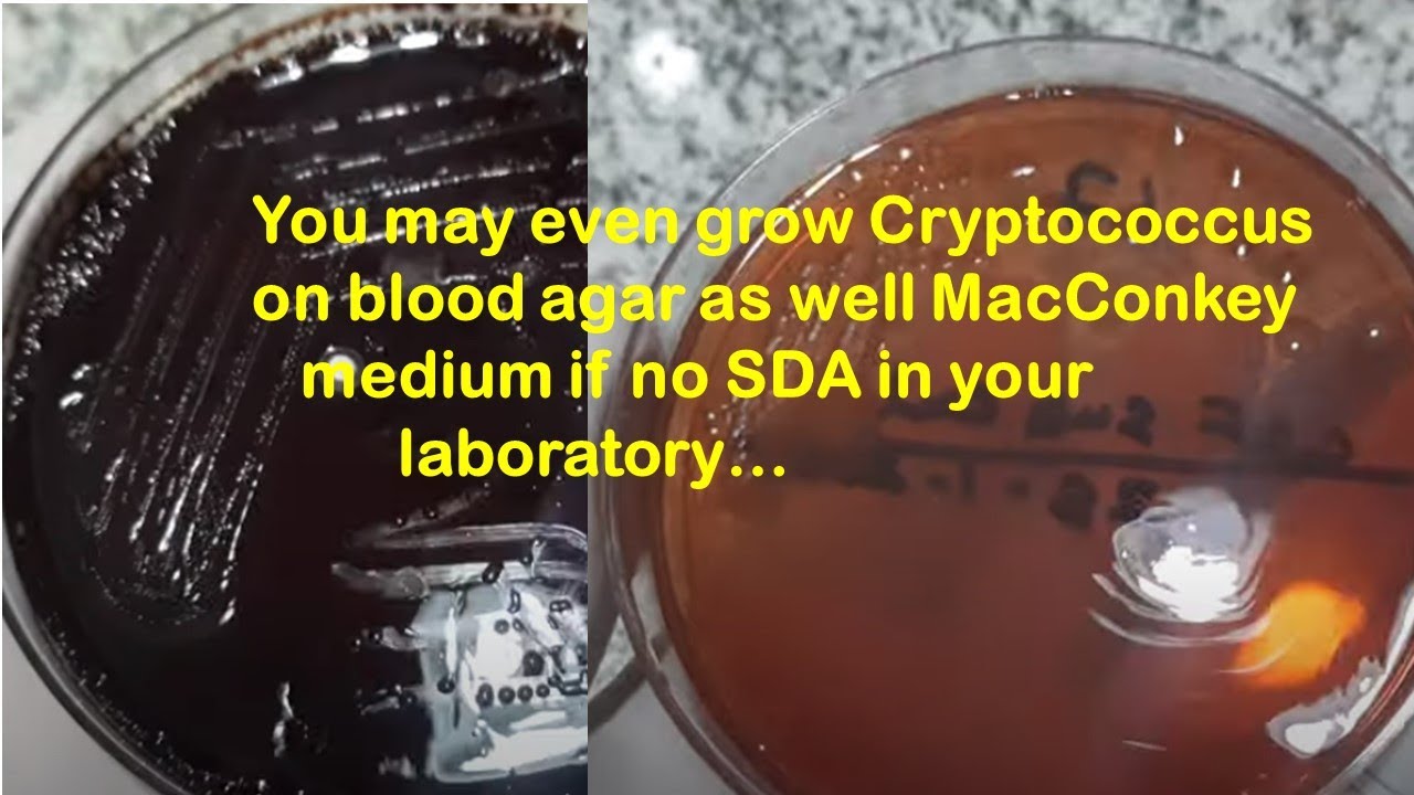 You may even grow Cryptococcus on Blood agar as well MacConkey if no ...