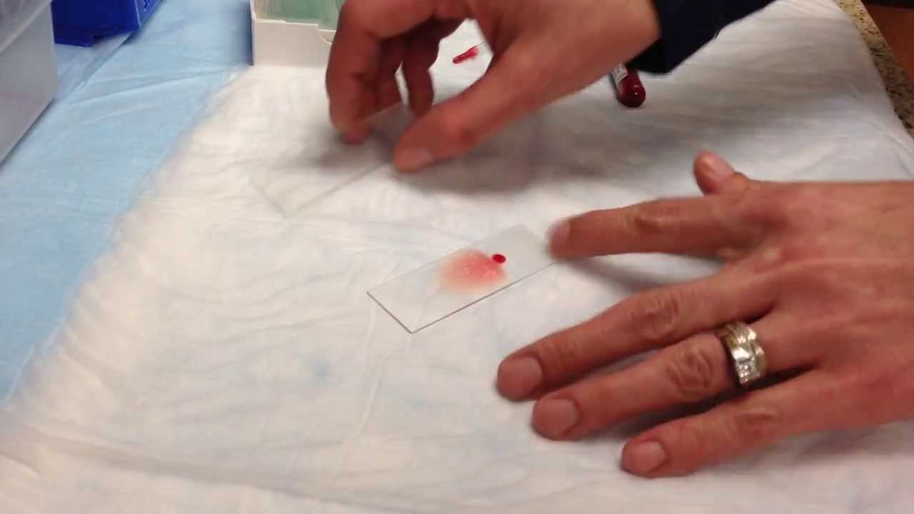 Frotis sanguineo - YouTube