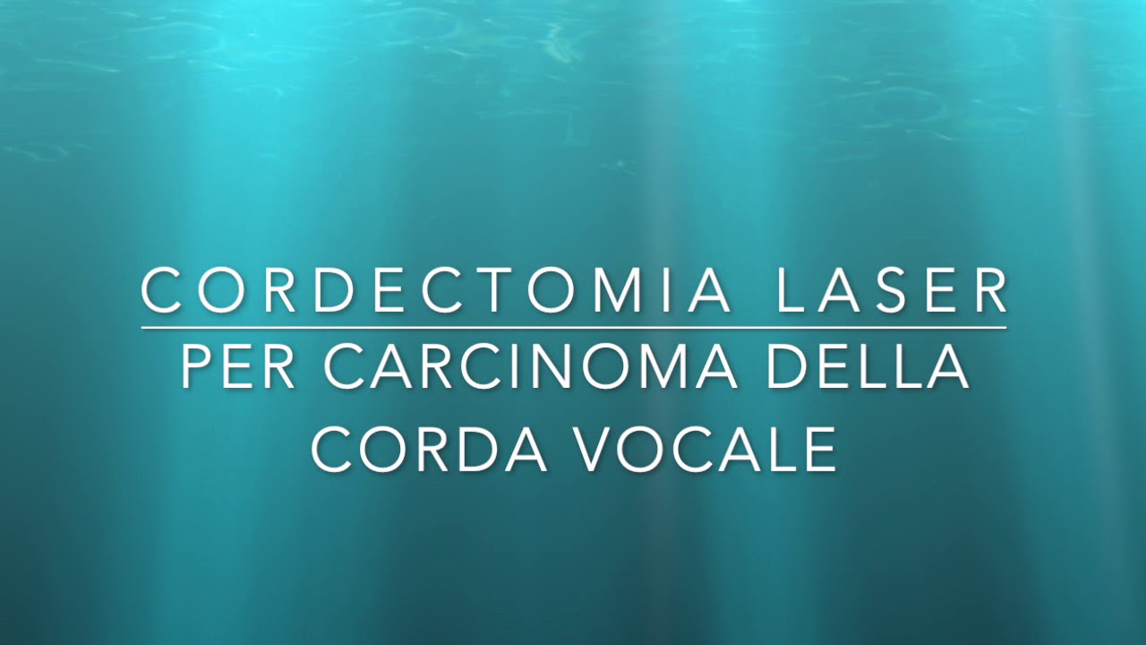 Cordectomia laser - Dr. Ignazio Tasca - YouTube