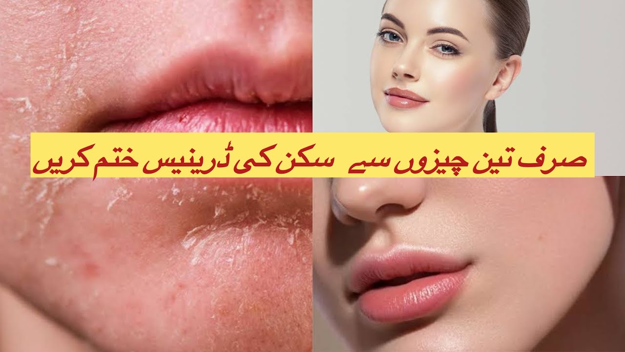 Dry-Dark Skin Remedy | Simple Home Remedies For Dry Skin | Get Glowing ...