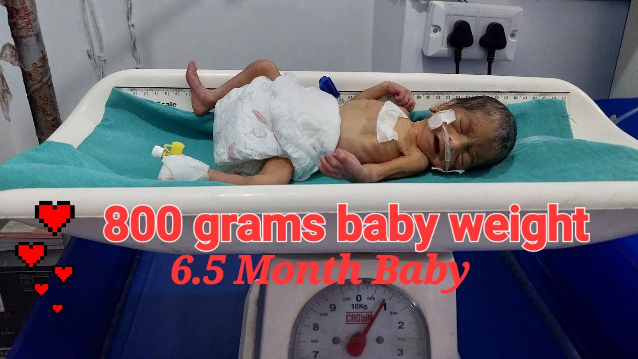 Preterm Baby Boy With 800 Grams Weight cute viralvideo doctor 