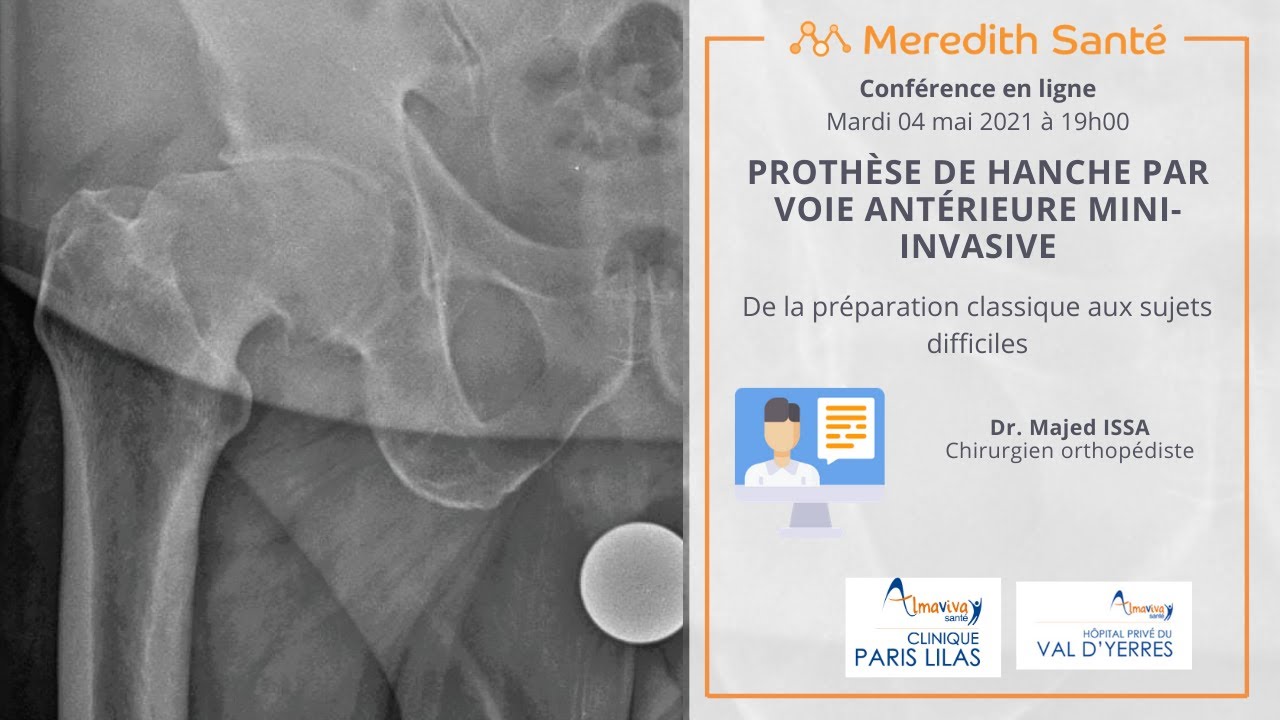 Prothèse de hanche par voie antérieure mini-invasive - Dr. Majed Issa ...