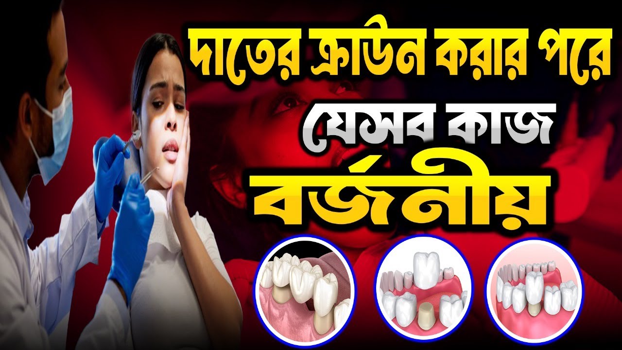 দাঁতের ক্রাউন করার পরে প্রয়োজনীয় পদক্ষেপ | Teeth crown treatment | Dr. Laboni - YouTube