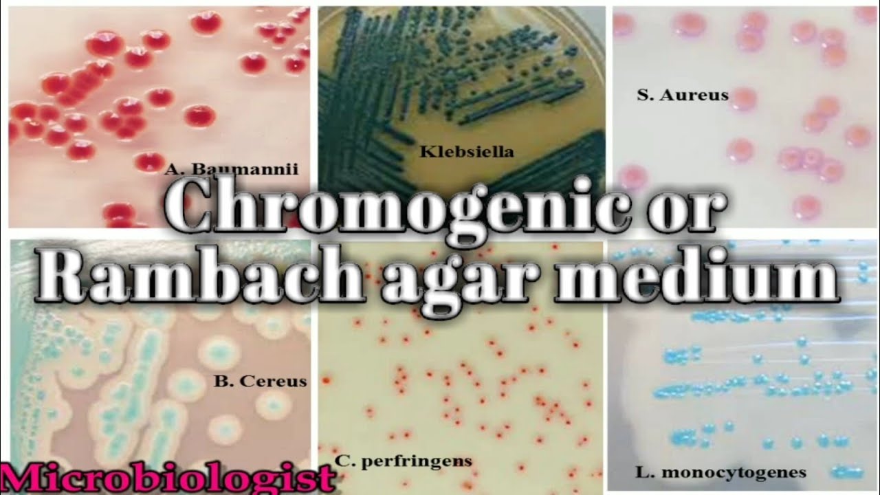 Chromogenic or Rambach agar medium: culture media lecture 25 - YouTube