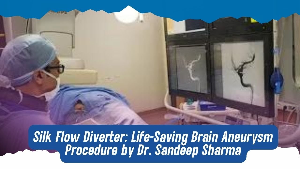 Silk Flow Diverter: Life-Saving Brain Aneurysm Procedure by Dr. Sandeep ...