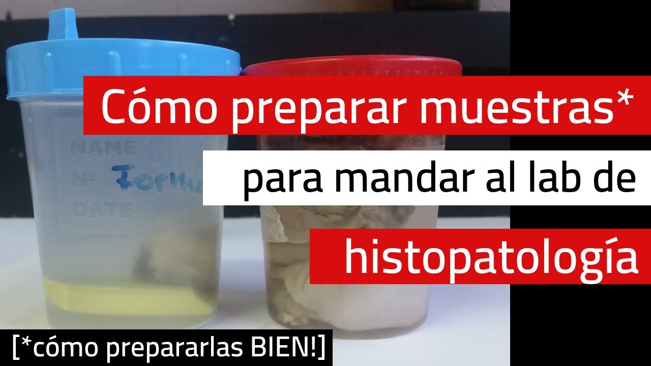 Muestras para histopatología: como prepararlas? - YouTube