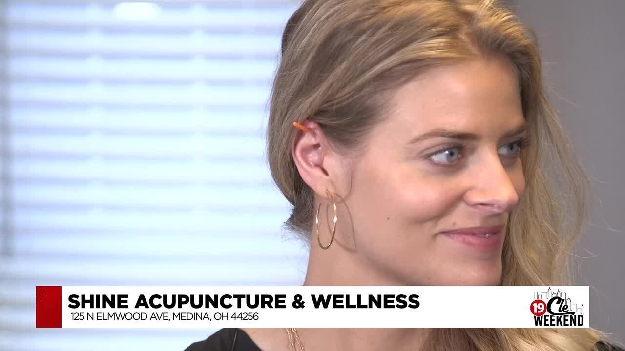 Find Your Path to Pain Relief and Relaxation at Shine Acupuncture ...