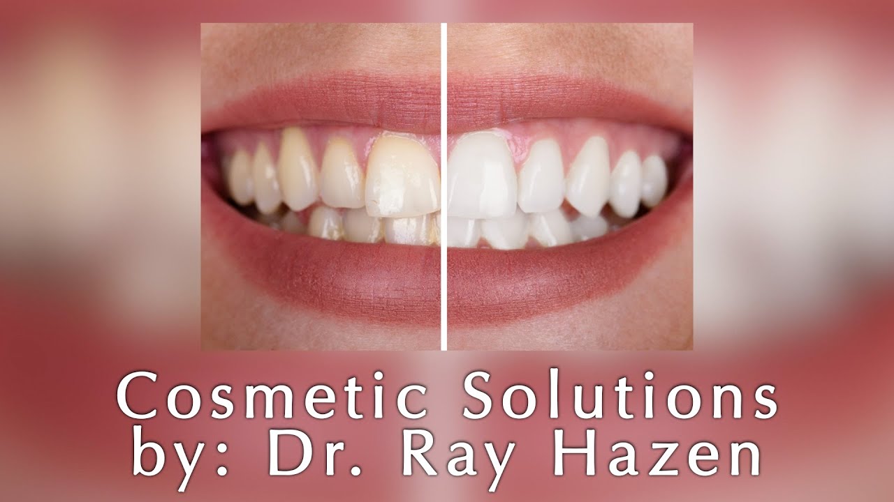 Cosmetic Options for When You Feel Self-Conscious About Your Smile ...