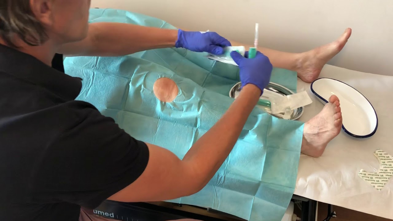 Punkcija koljena - YouTube