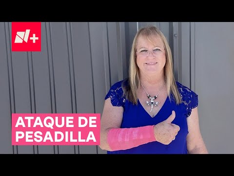 Mujer sobrevive al ataque de un halcón que le tiró una serpiente desde el cielo - N+