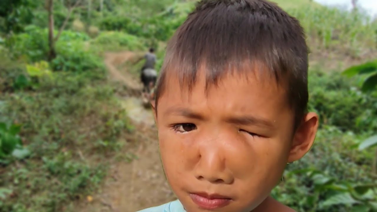 BUKOL SA ILONG ANONG DAHILAN | DISKARTE NG BUHAY - YouTube