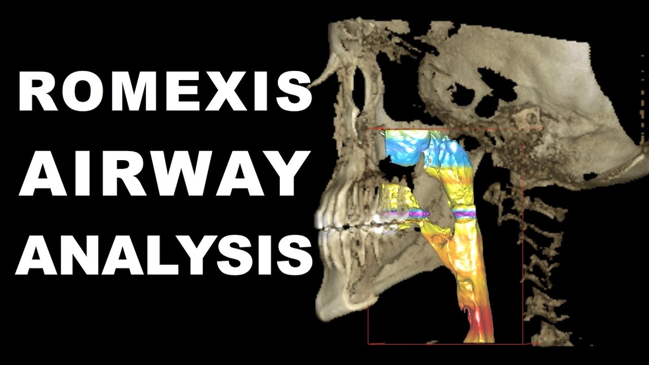 Romexis Airway Analysis - YouTube