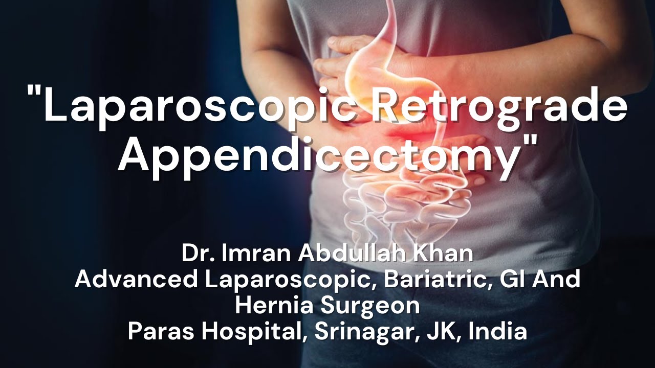 Laparoscopic Retrograde Appendicectomy | Dr. Imran Abdullah Khan - YouTube