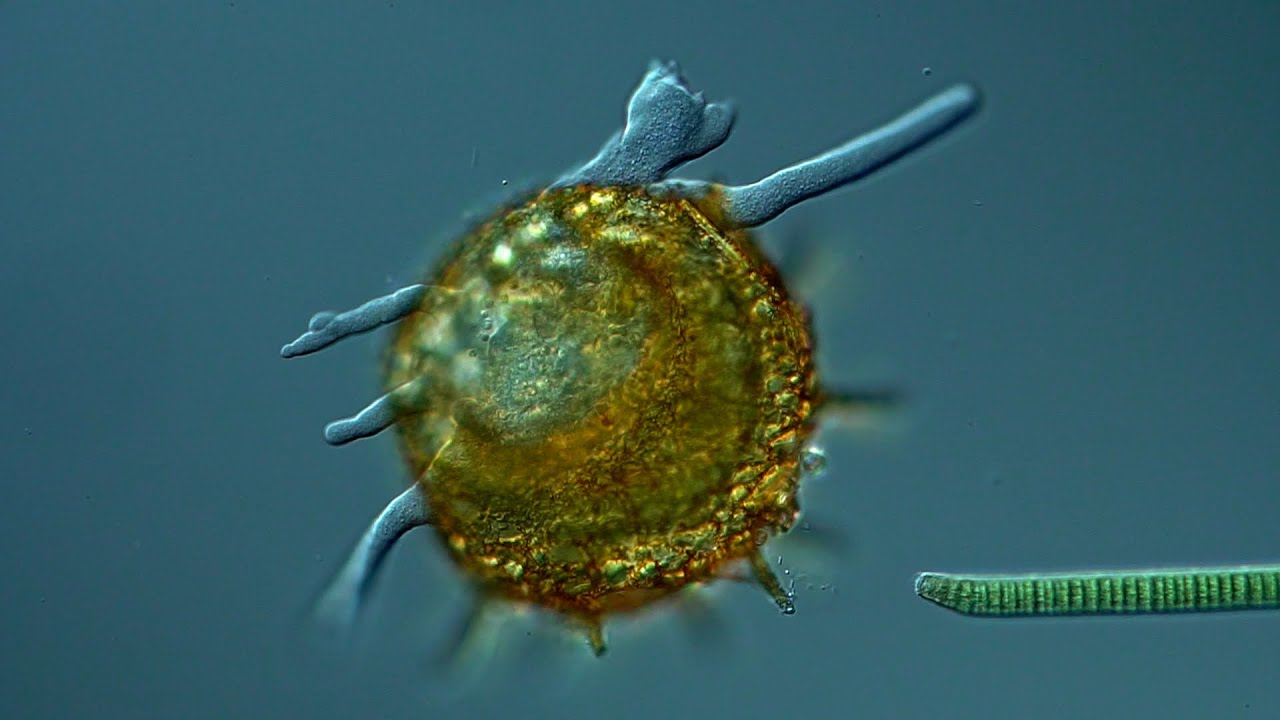 Centropyxis aculeata testate amoeba - YouTube