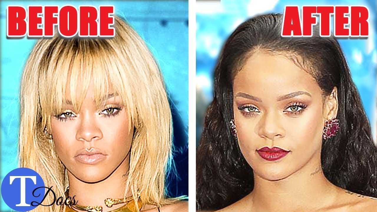 Celebrities As Children Before And After