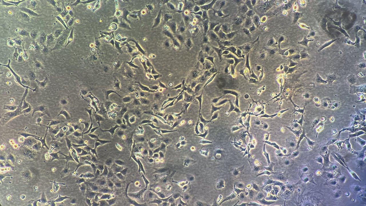 How we maintain our cells# cell culture #trypsinization of cell - YouTube