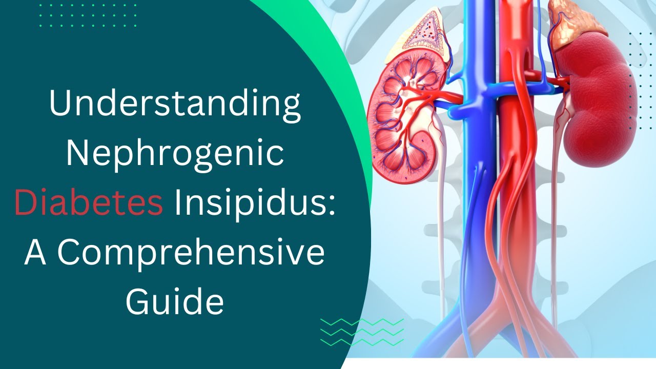 Understanding Nephrogenic Diabetes Insipidus: A Comprehensive Guide ...