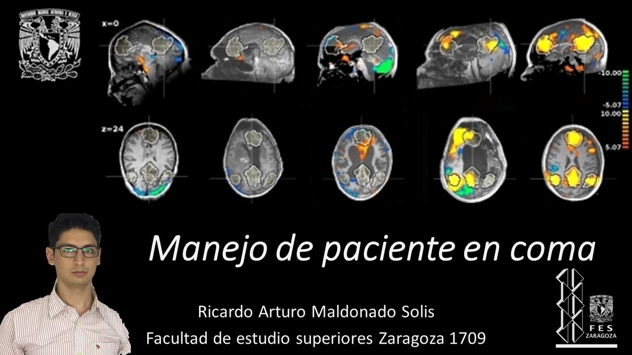 En coma, definición, diagnóstico y manejo - YouTube