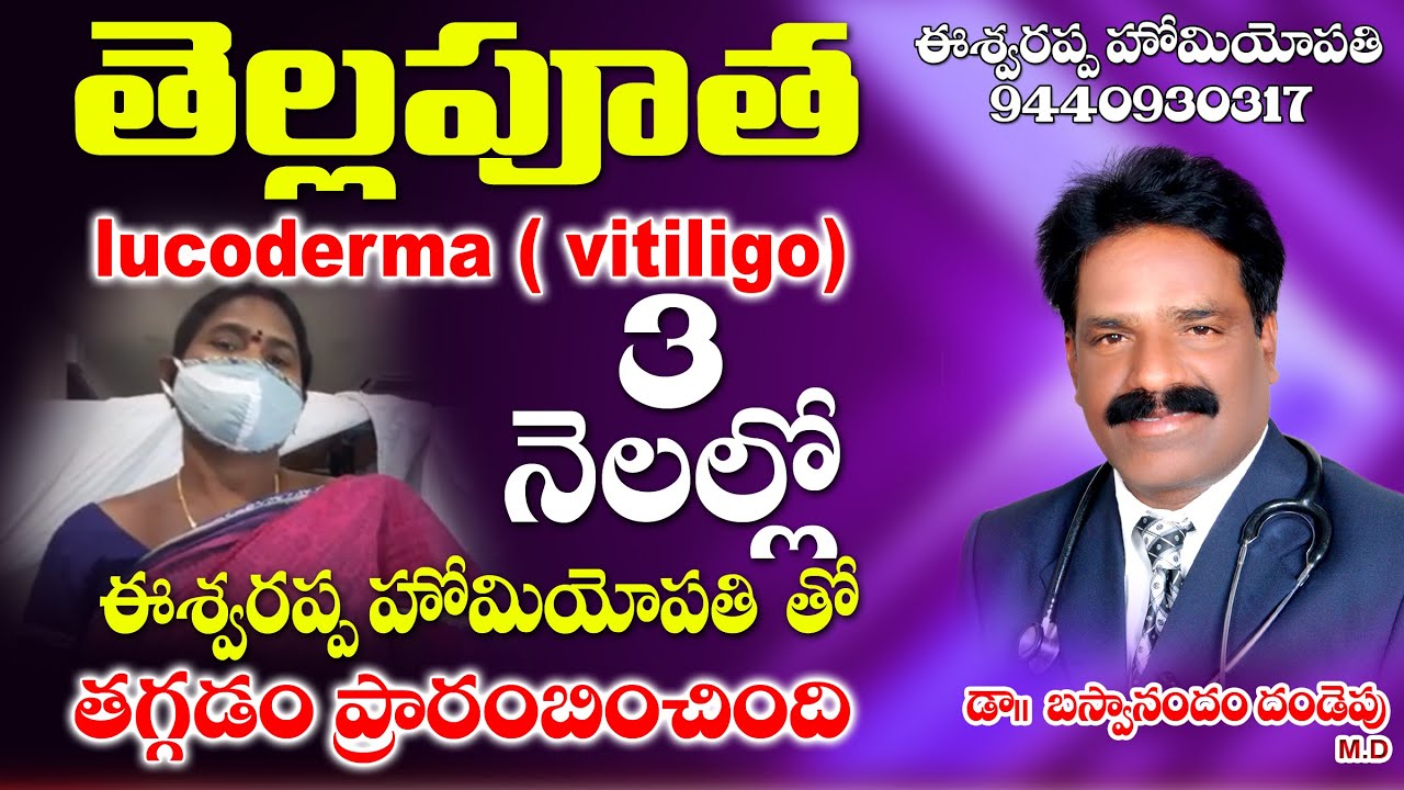 lucoderma ( vitiligo) cured at Eshwrappa Homeo clinic, Bangalore ...